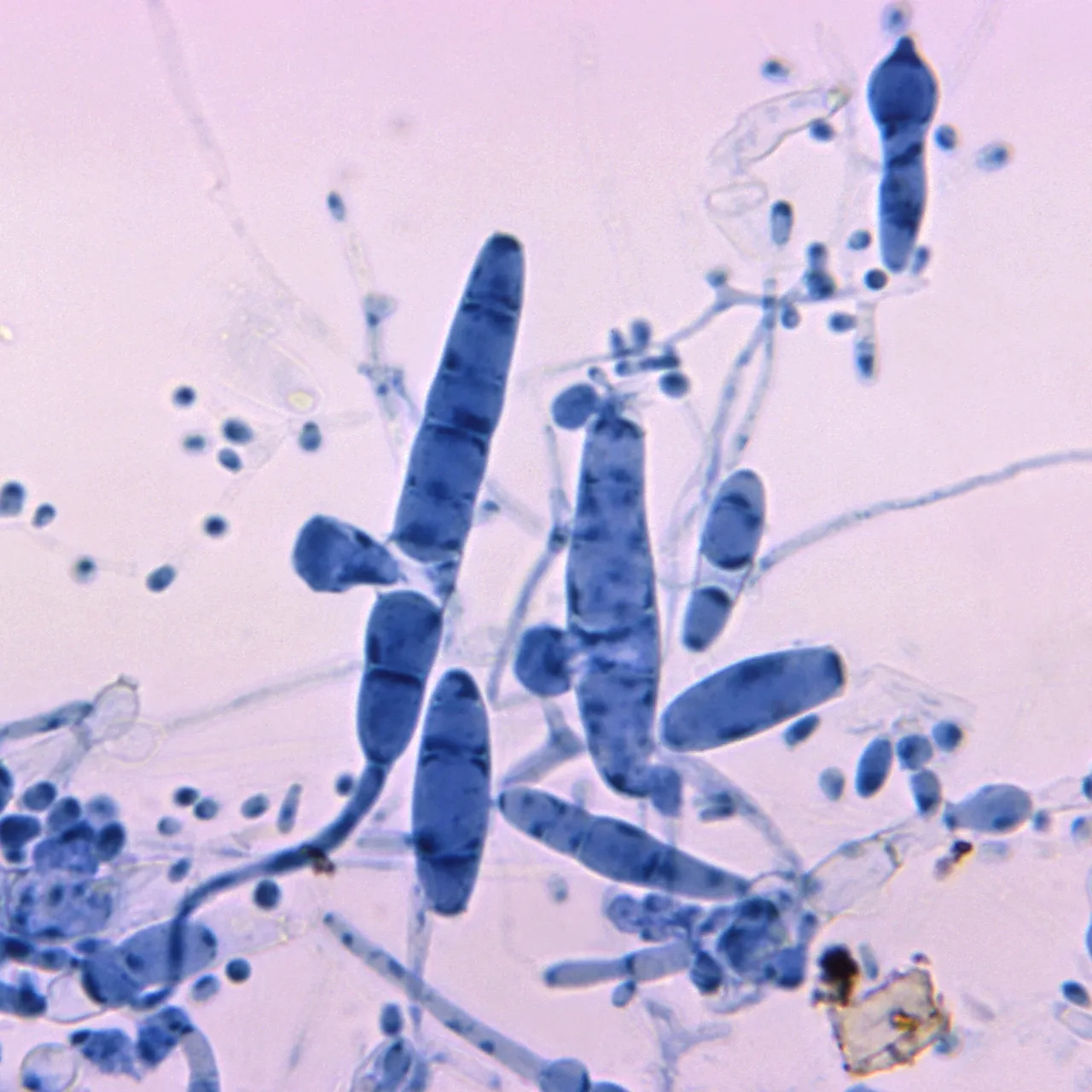 ringworm under microscope