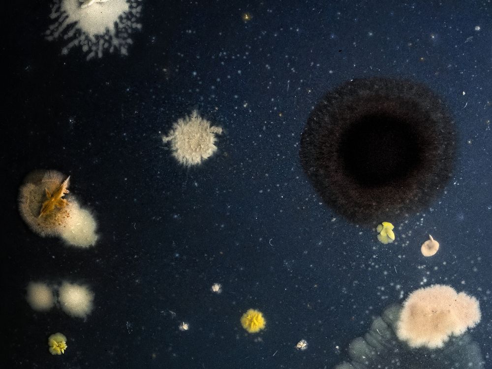 Plaque bacteria | Smithsonian Photo Contest | Smithsonian Magazine
