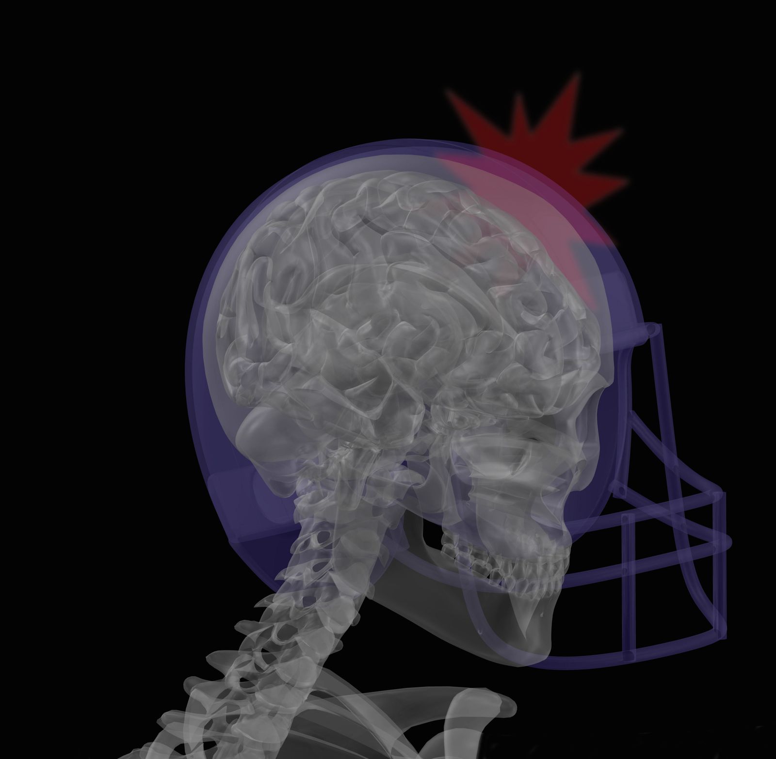 How Virtual Reality and Sideline Brain Scans Could Help Diagnose ...