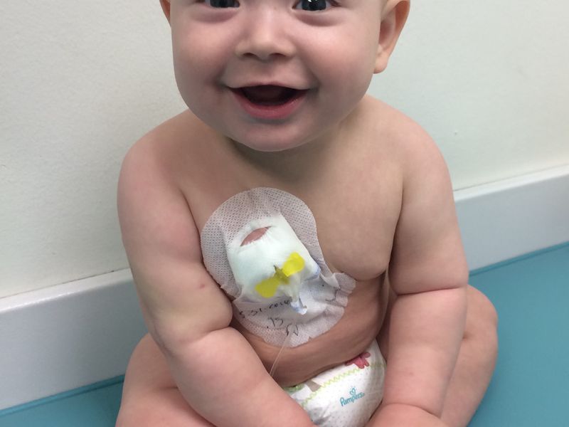 Happy cancer baby during visit to Texas Children's Cancer Center ...