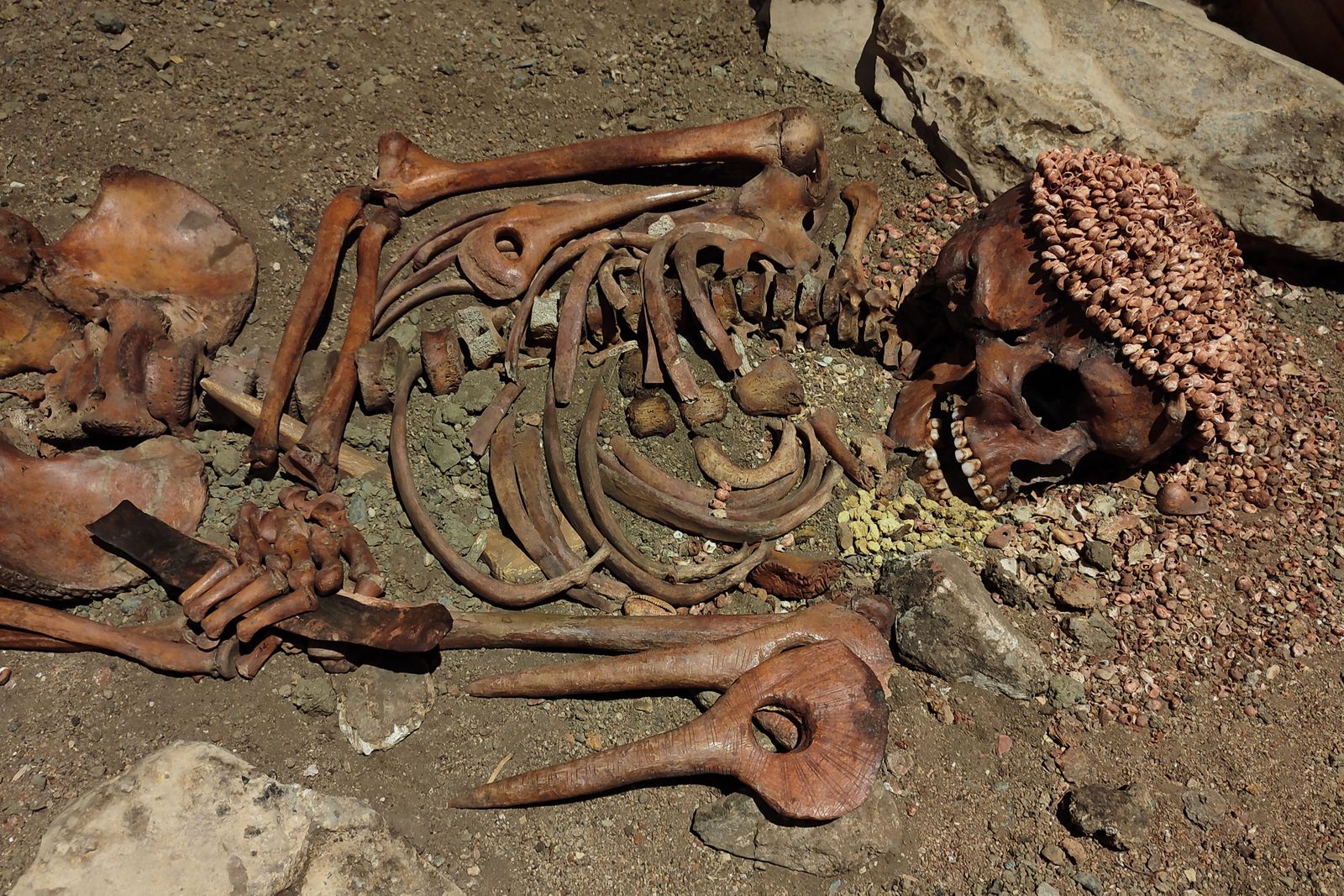Researchers Say This Paleolithic Teenage Boy Died a Slow Death After a ...