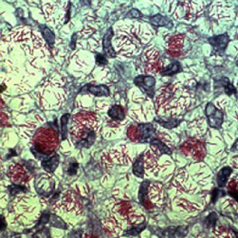Mycobacterium Leprae Microscope