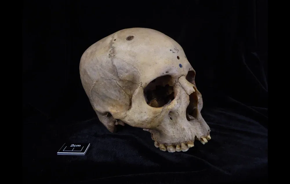 Groundbreaking Research Shows Ancient Egyptians Were Conducting Cancer ...