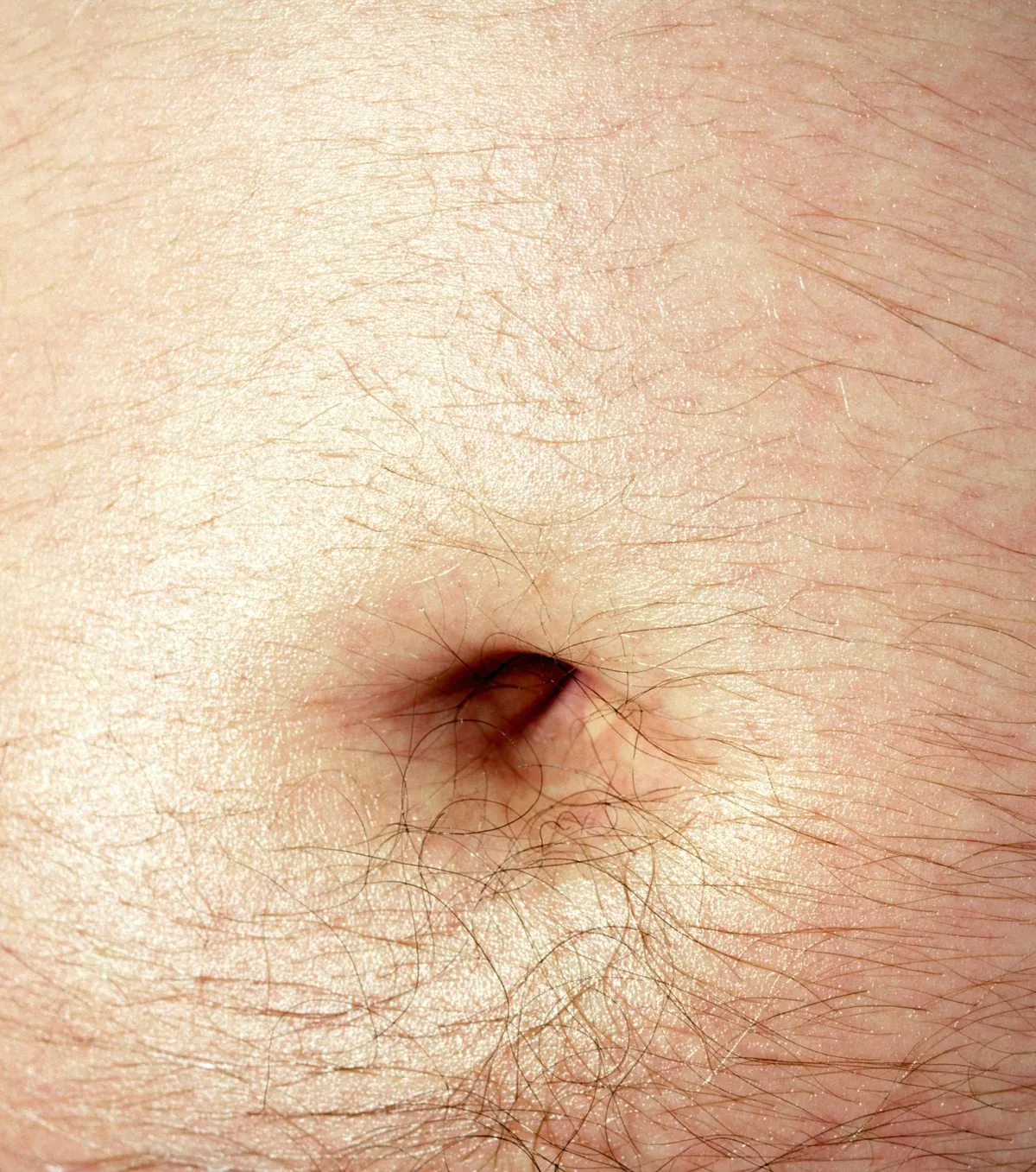 gross belly button