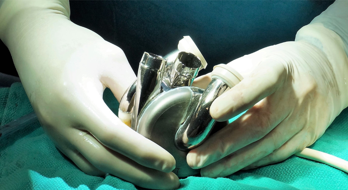 Australian Man Makes History by Living With a Titanium Heart for More ...