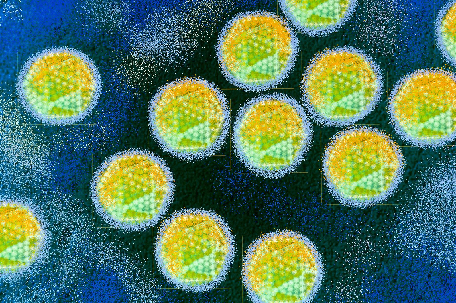 50,000-Year-Old Neanderthal Bones Have Remains of Human Viruses ...