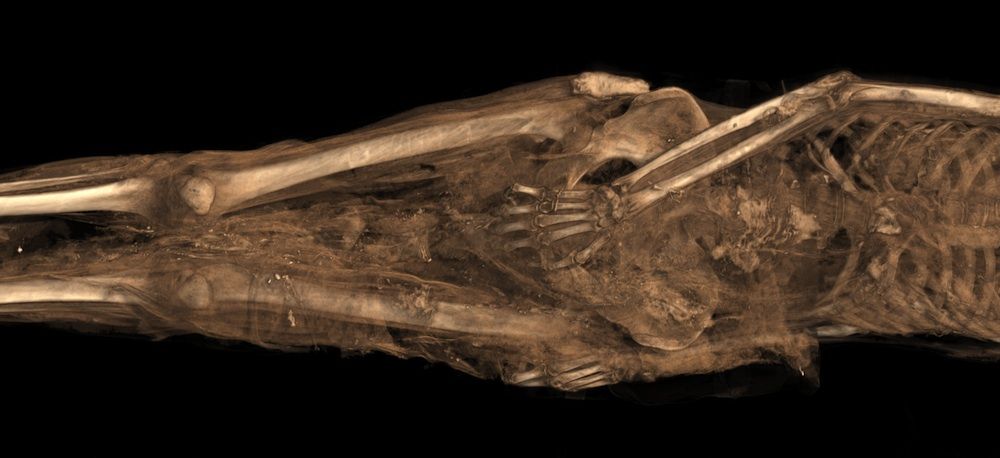 This Mummy Had an Angel Tattooed on Her Leg