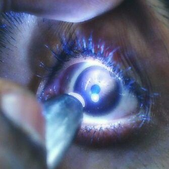 rays in the eye sight shows good | Smithsonian Photo Contest ...