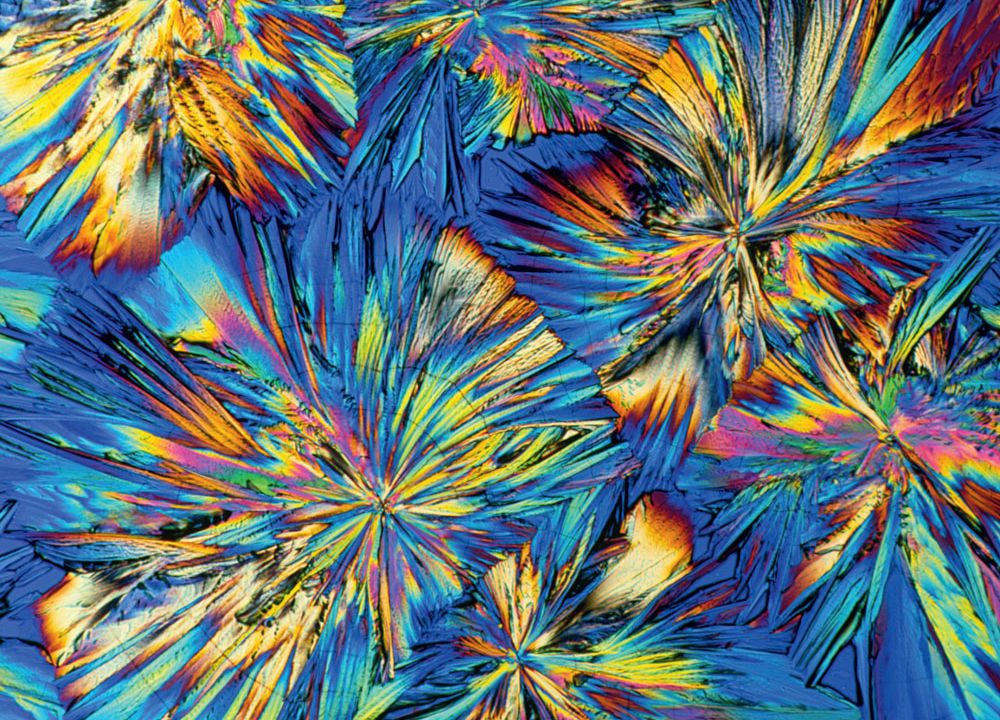 astrosclereids under microscope