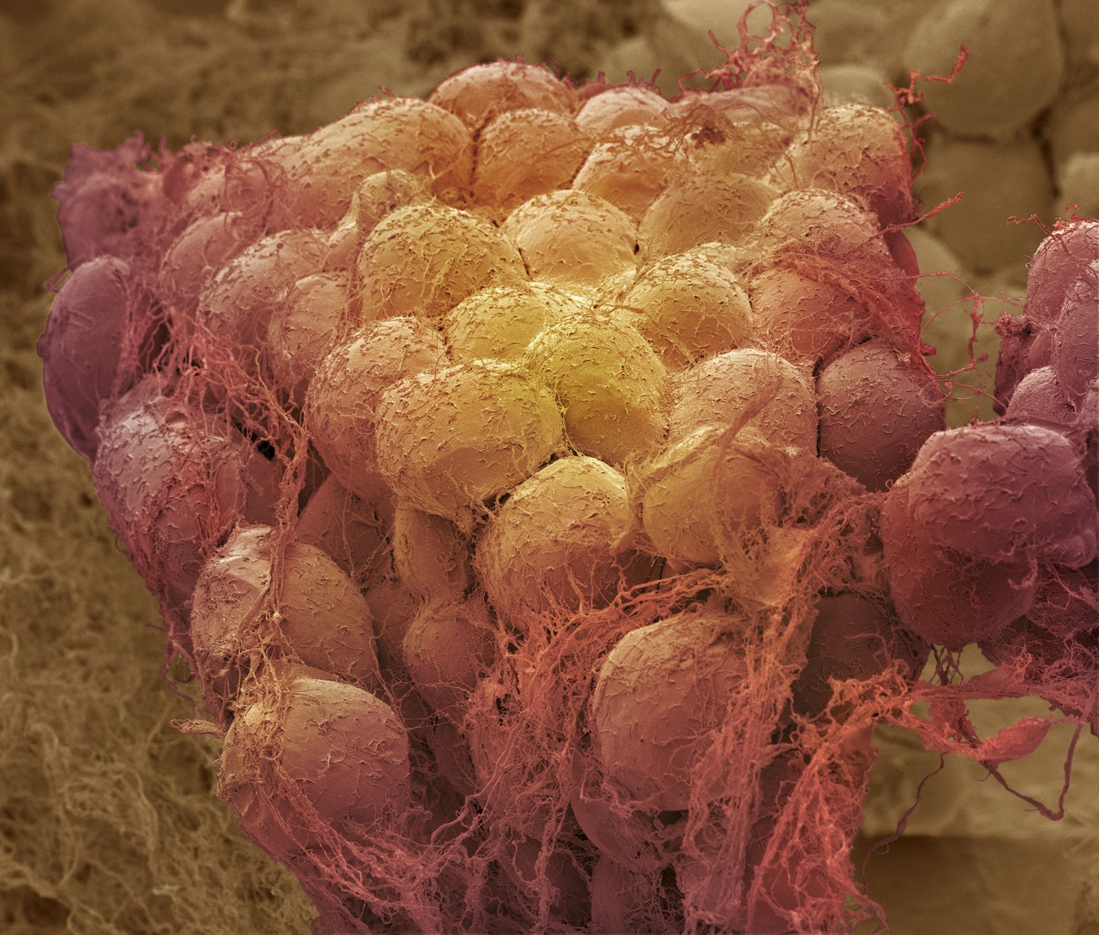 Fat Cells Retain a 'Memory' of Obesity, Making It Hard to Lose Weight ...
