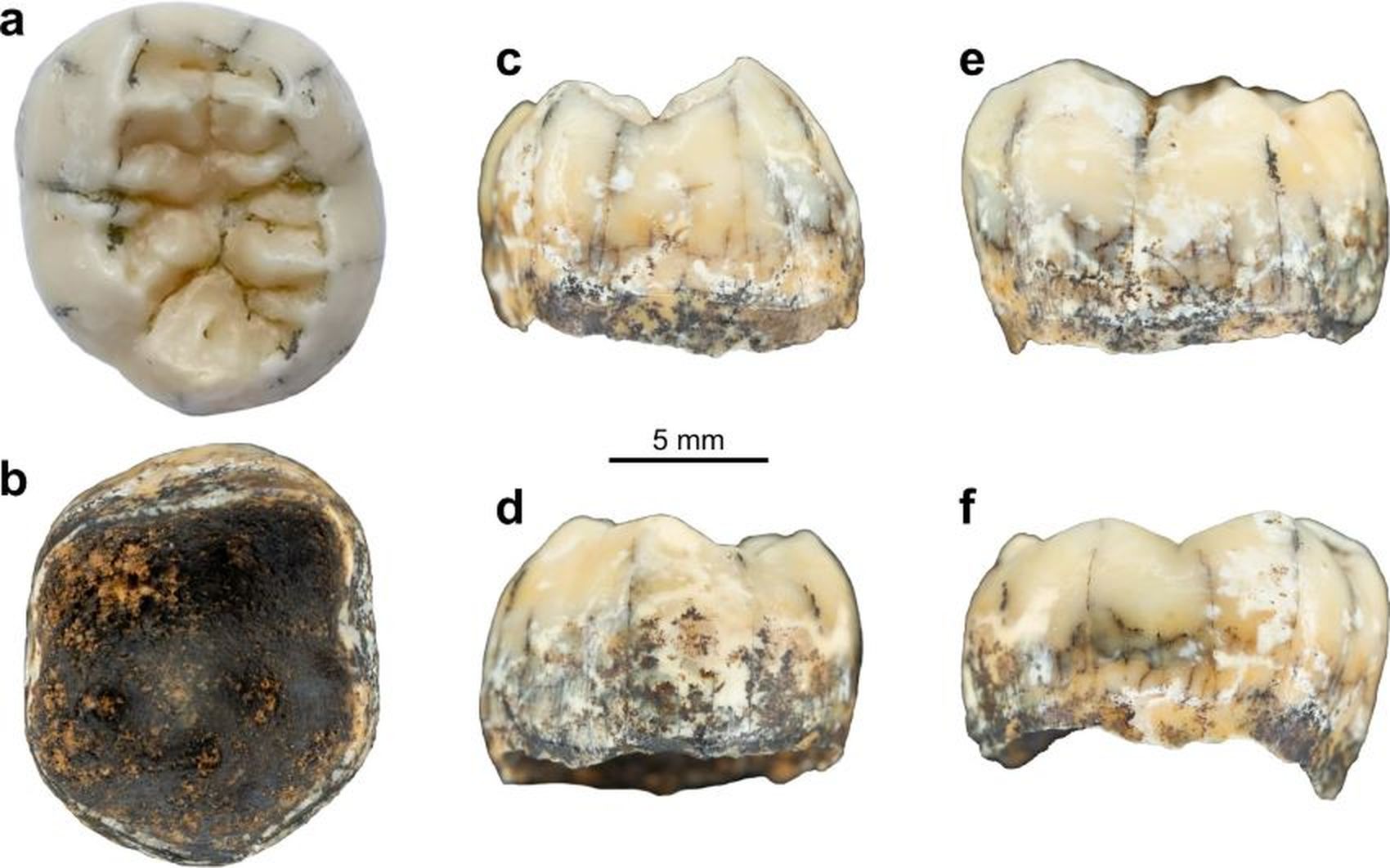 Ancient Molar Found in Laos Could Help Fill in a Gap in Human History