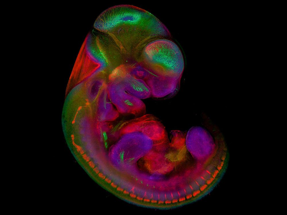 bee eye under microscope