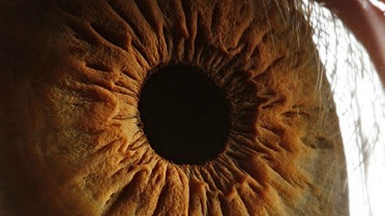 Strange Human Shaped Irises