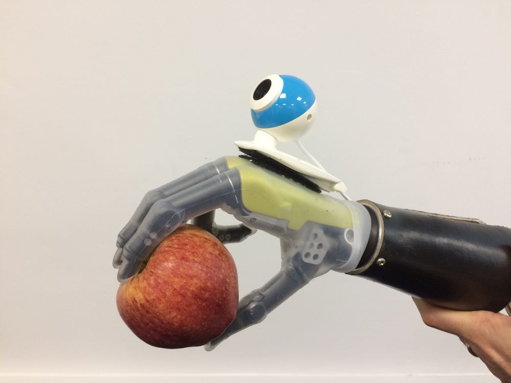 Prosthetic Limb 'Sees' What Its User Wants to Grab