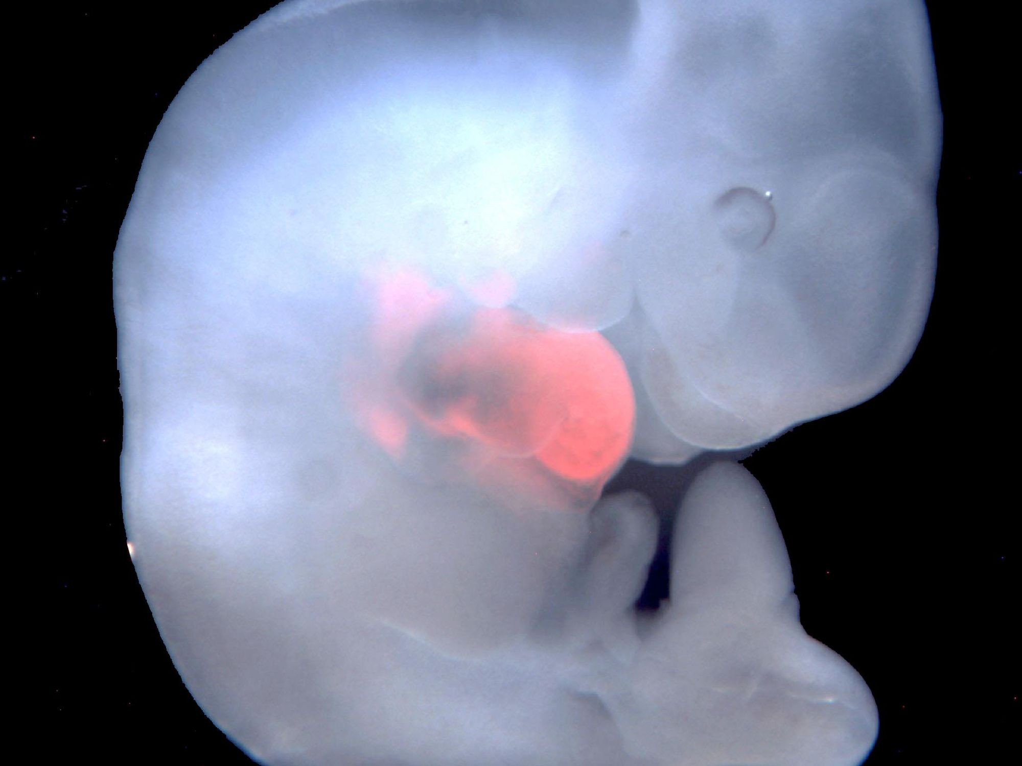 Human-Pig Chimeras Created for the First Time