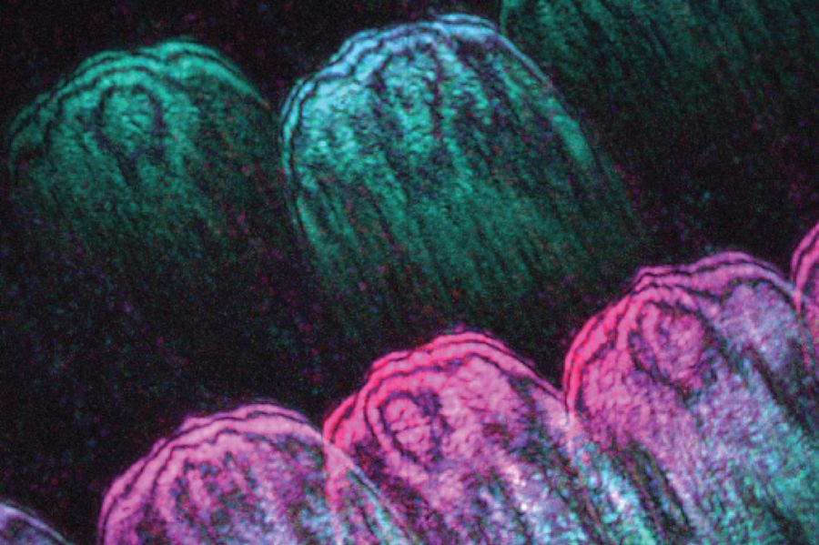 butterfly wing under microscope