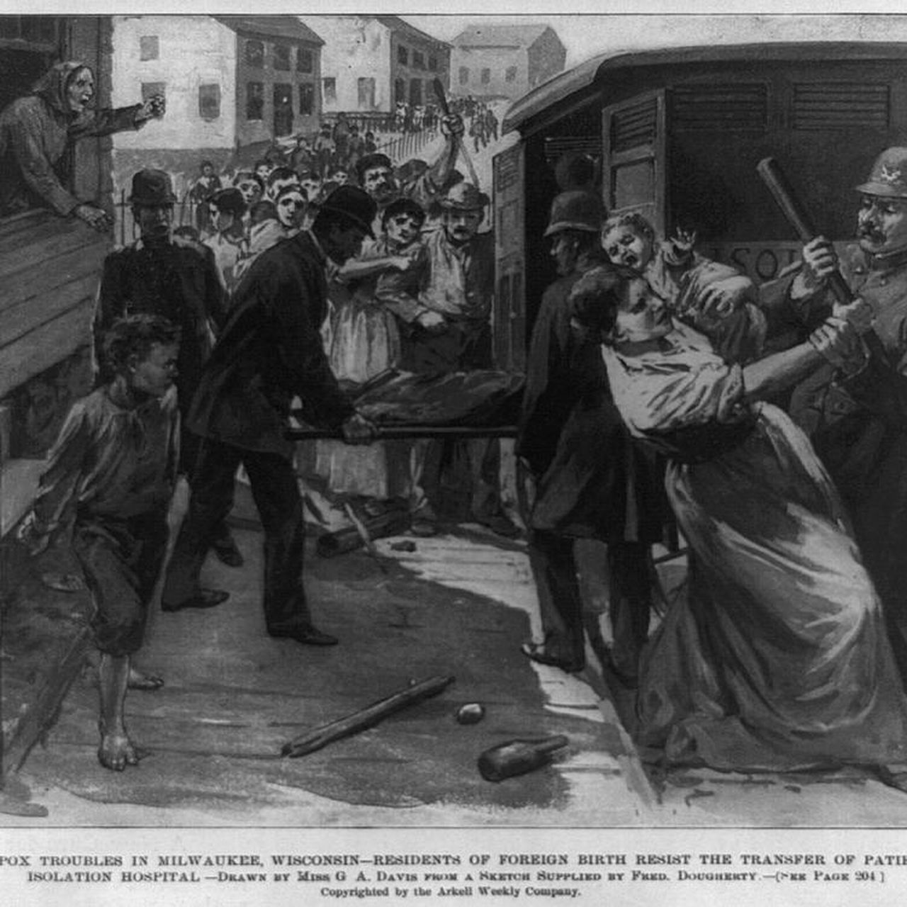 People With Smallpox