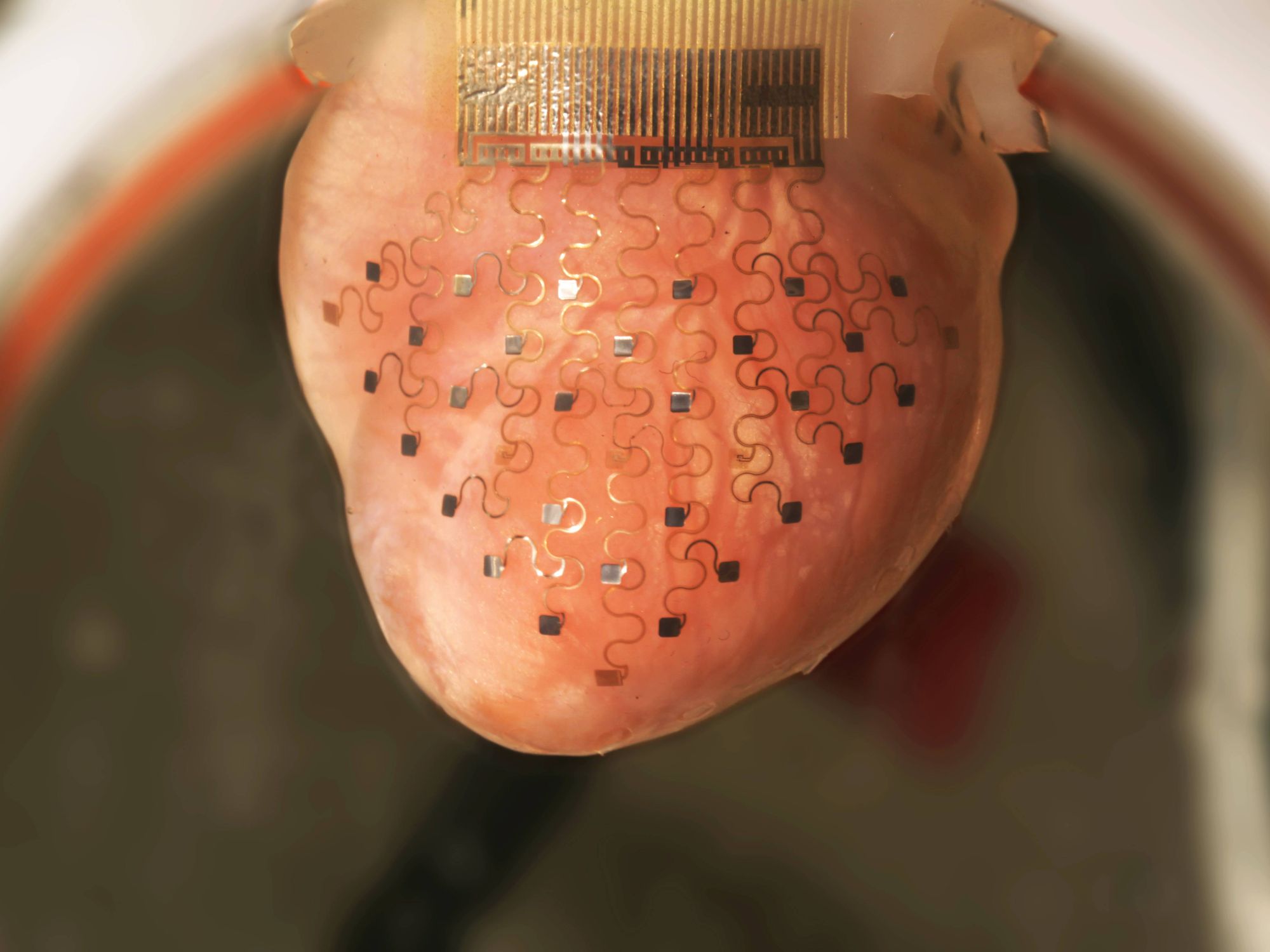This Wearable 'Heart Sock' May Someday Save Lives