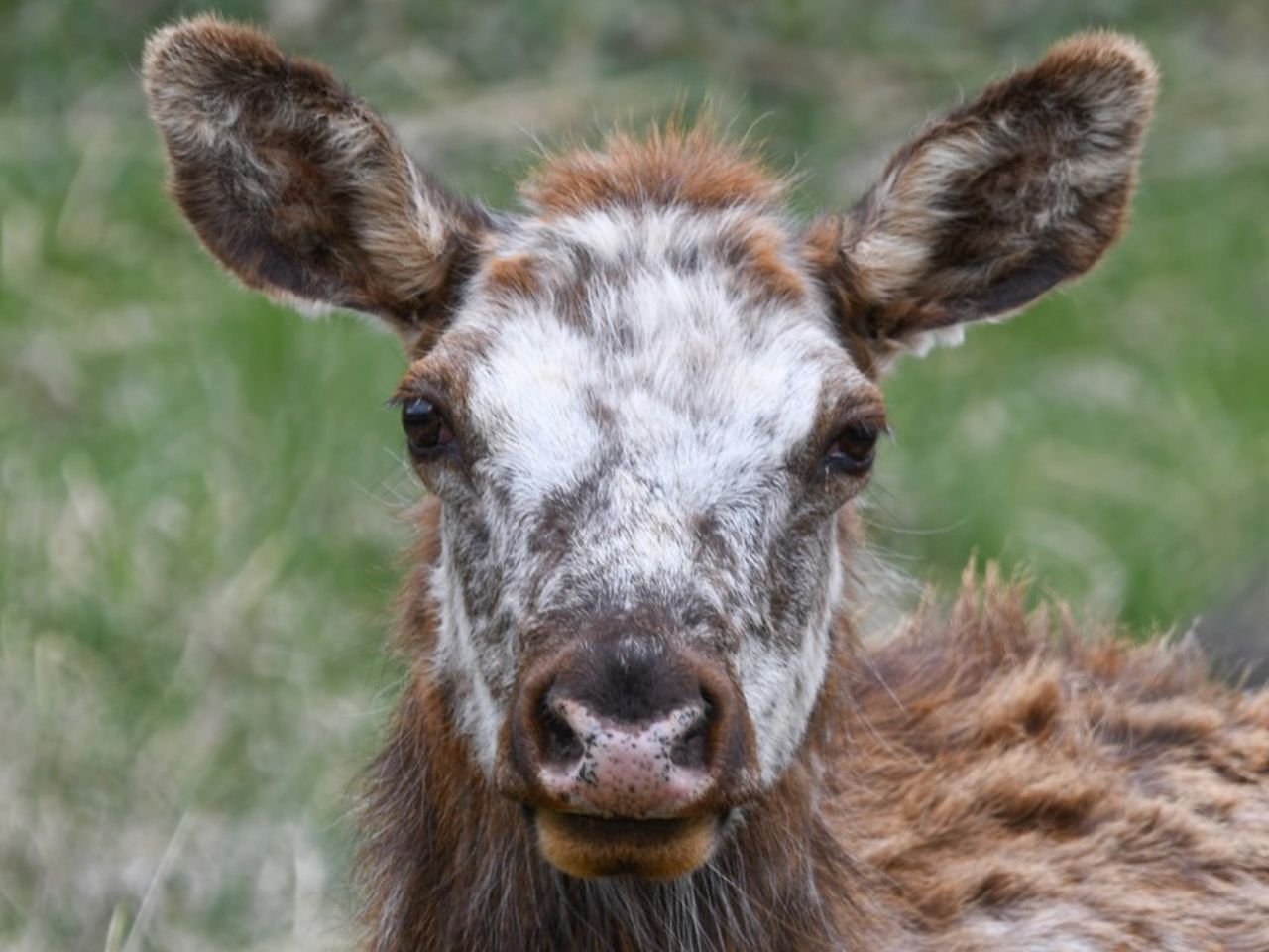 piebald condition human