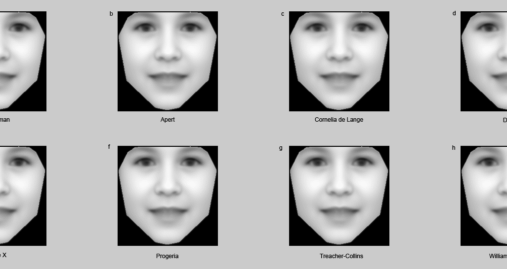 abnormal looking people