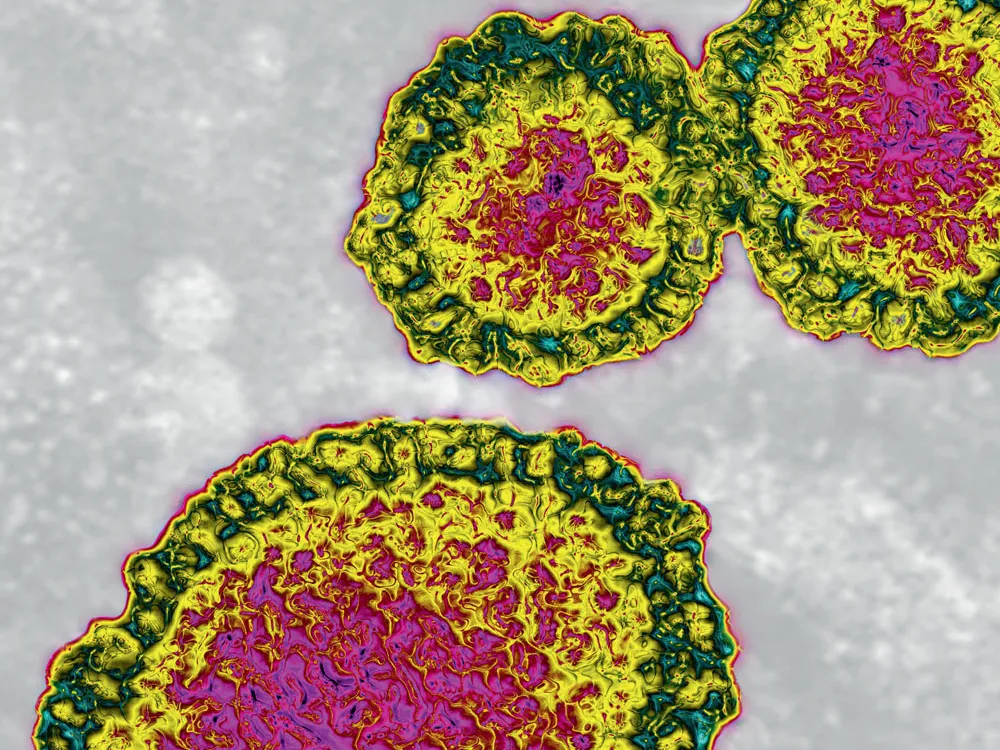 virus under light microscope