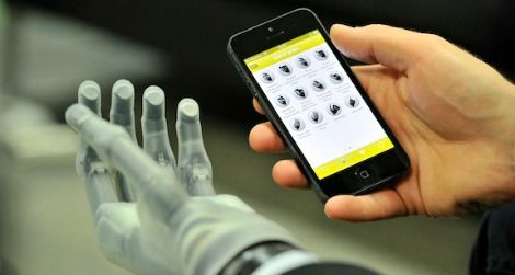 This 16-Year-Old Has a Bionic Hand Almost as Good as Luke Skywalker’s ...
