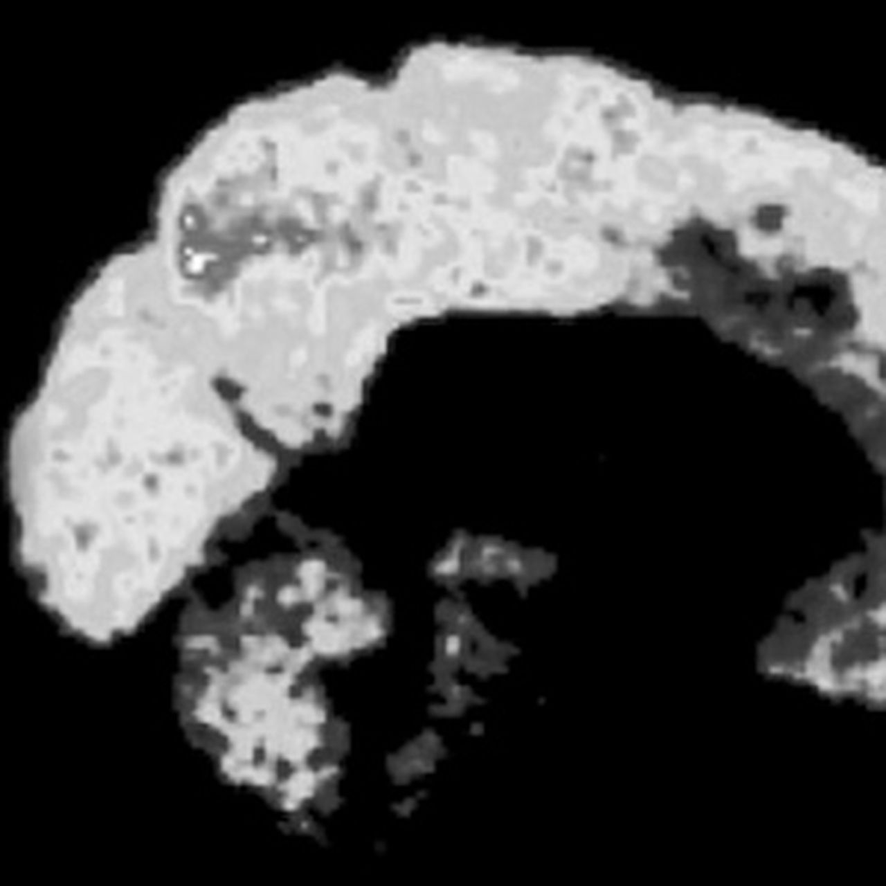 Psychopath Brain Scan