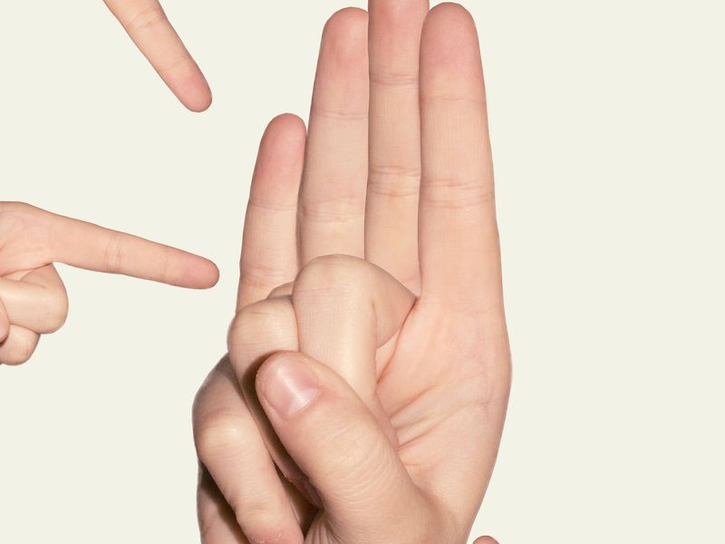 A variety of strange hands. | Smithsonian Photo Contest | Smithsonian ...