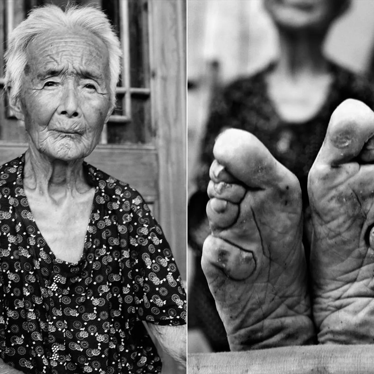 Ancient Chinese Women Foot Binding