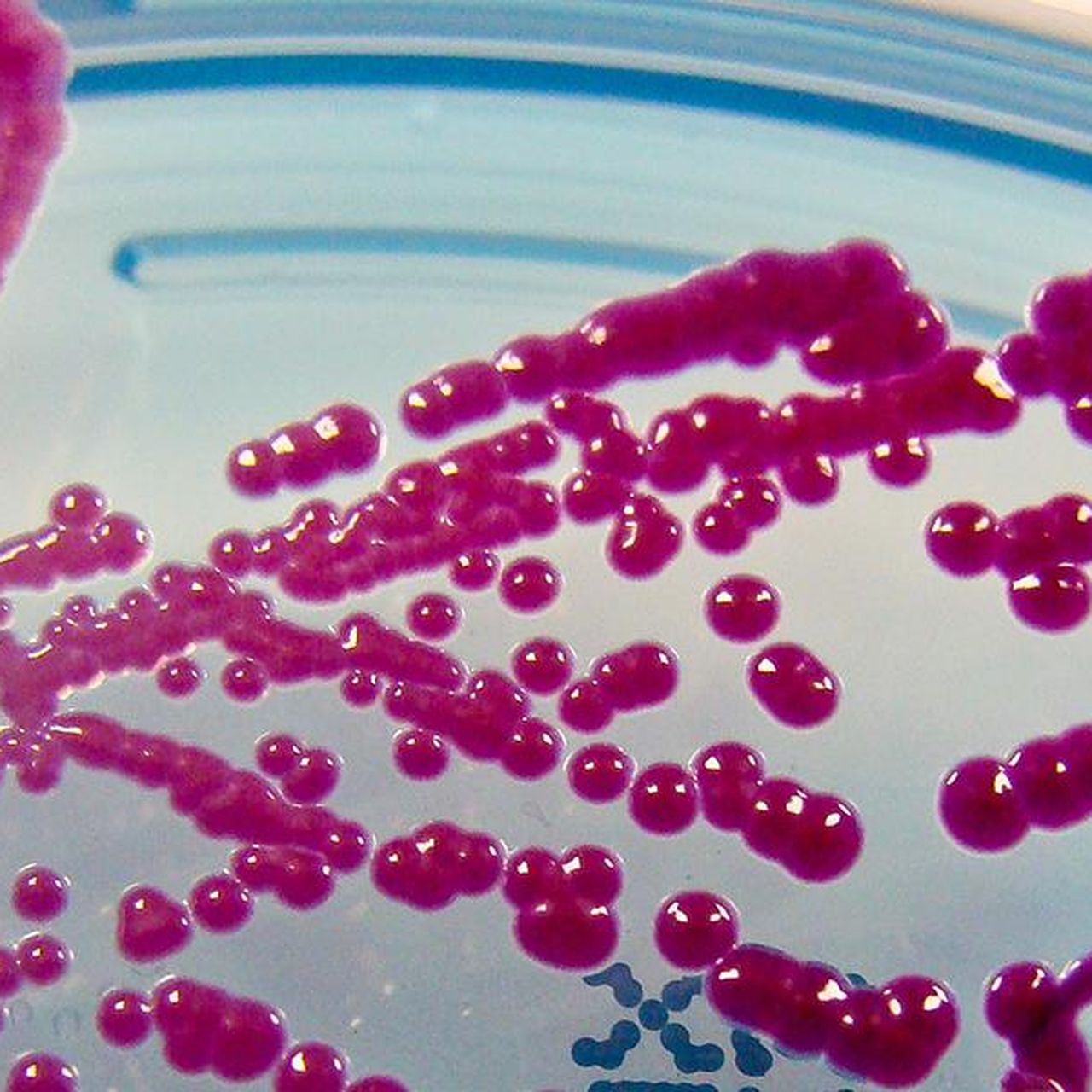 Serratia Marcescens Gram Stain