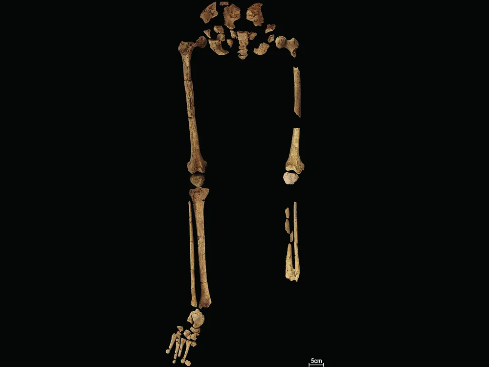 Earliest Known Amputation Was Performed in Borneo 31,000 Years Ago