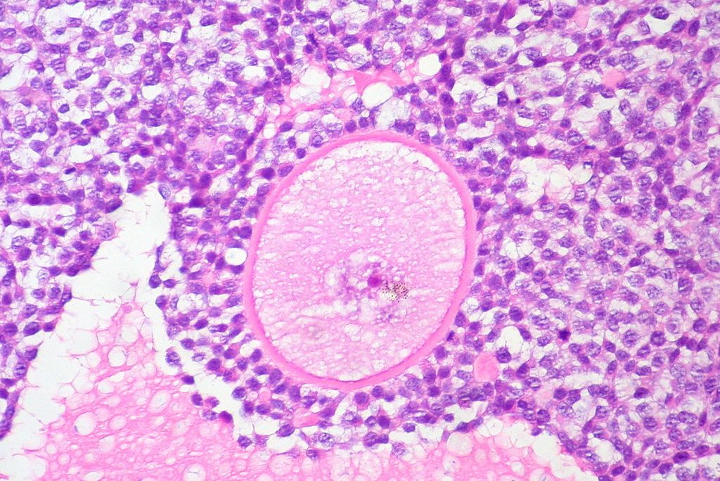 human ovaries under microscope