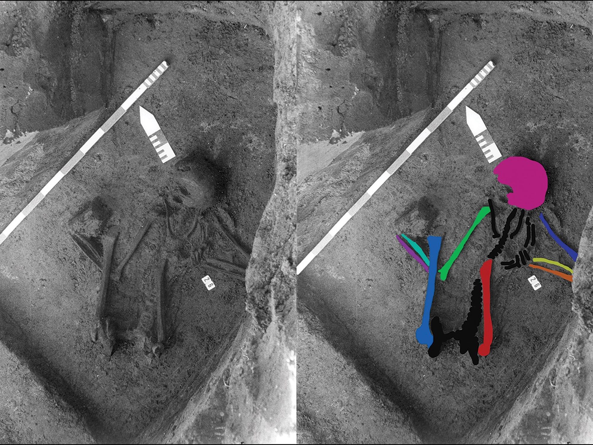 Archaeologists Are Bewildered by a Skeleton Made From the Bones of at ...