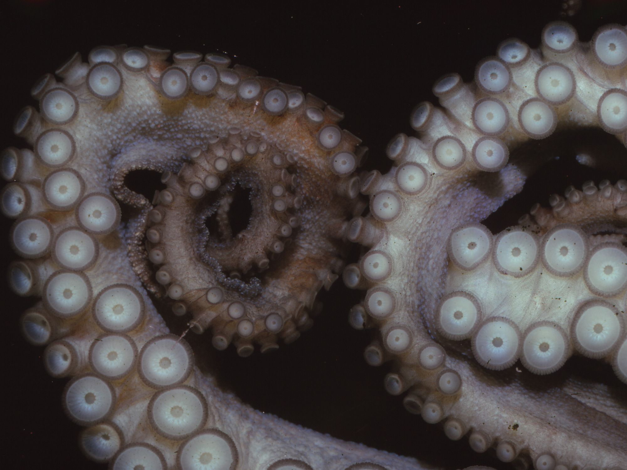 New Patch Inspired by Octopus Suckers Could Deliver Drugs Without Needles