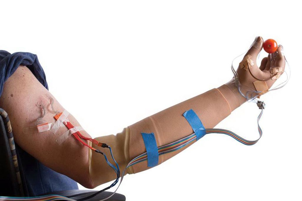 how does a bionic arm work