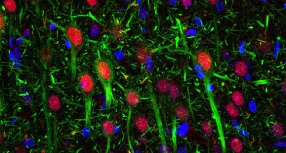 Dieting May Cause The Brain to Eat Itself