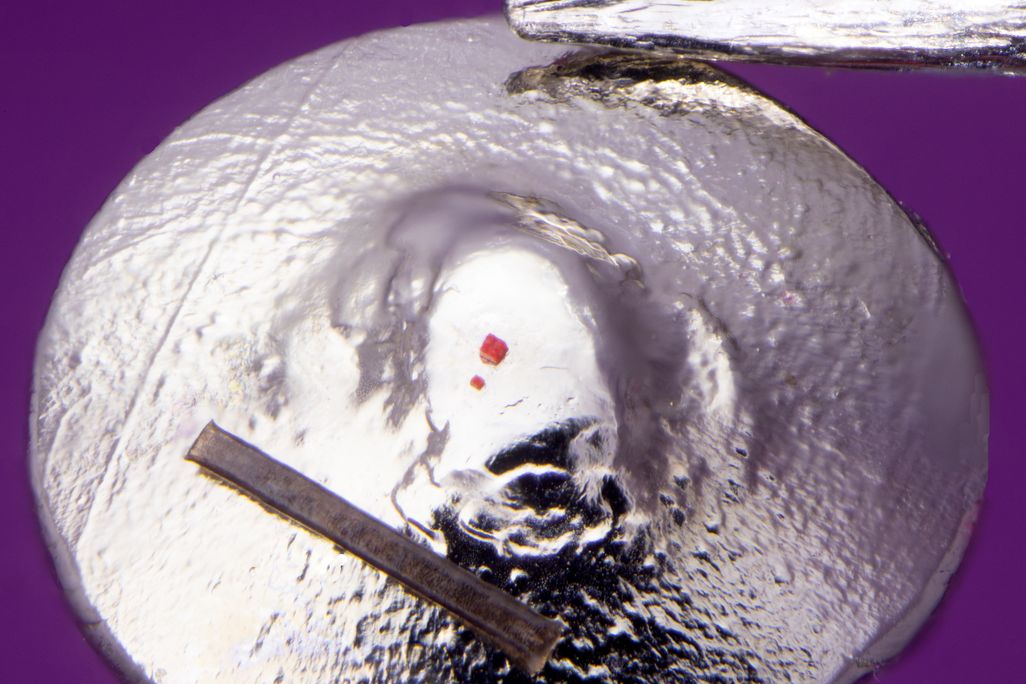 world's smallest human head