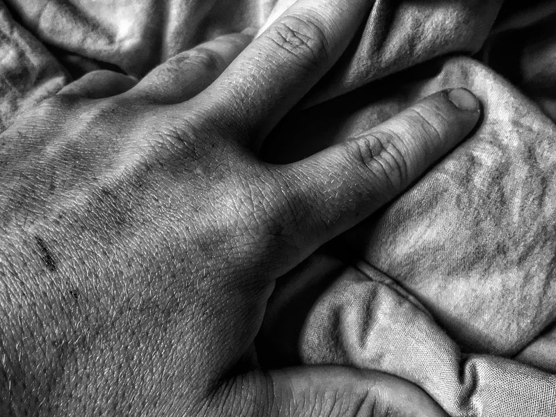 The damaged hand | Smithsonian Photo Contest | Smithsonian Magazine