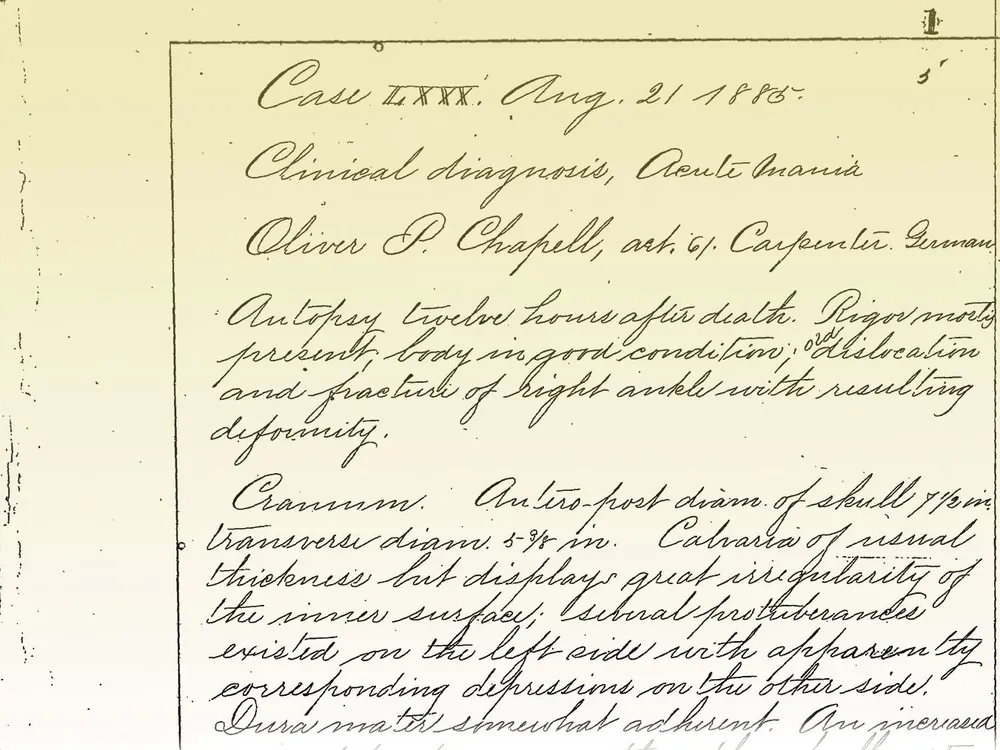 Did Civil War Soldiers Have PTSD?