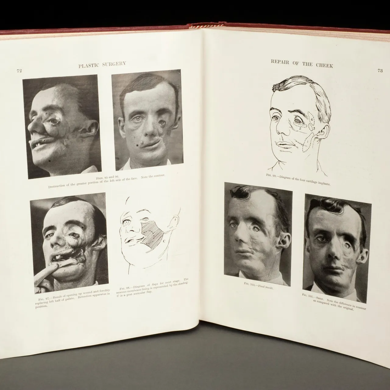 smashed face disease