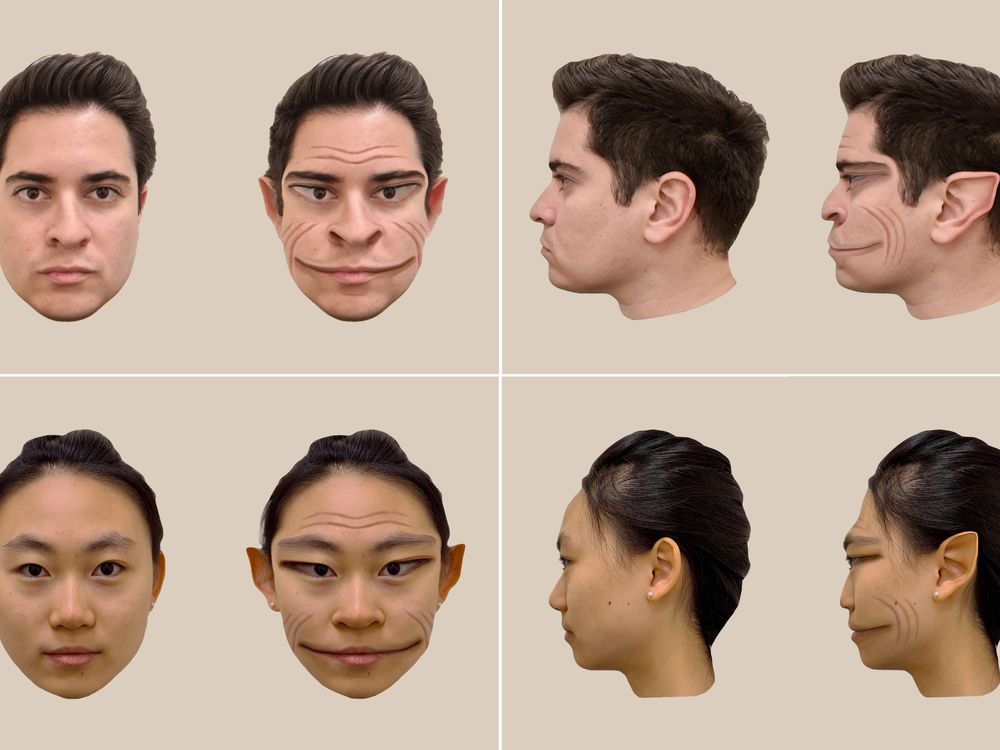 This Extremely Rare Neurological Condition Makes Faces Appear Distorted ...