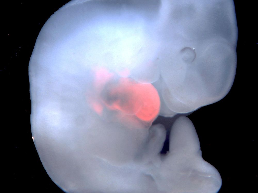 Human-Pig Chimeras Created for the First Time