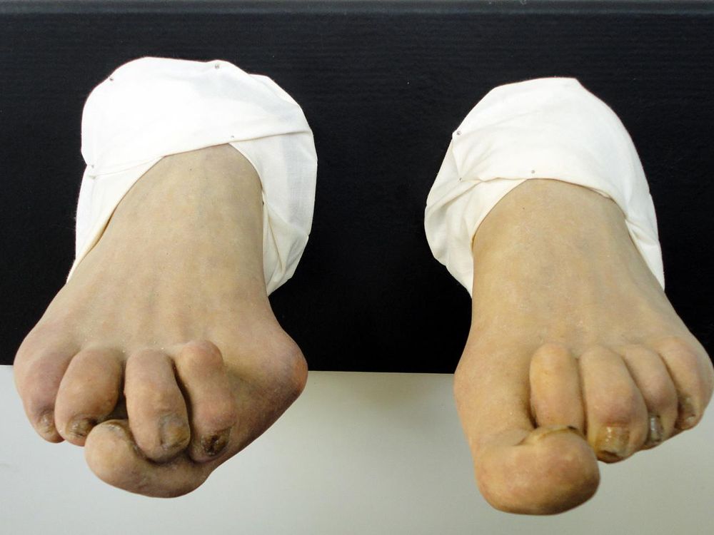 See Over 2,000 Wax Models of Skin Diseases at This Swiss Medical ...