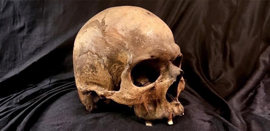 With Ancient DNA, Scientists Have Mapped 37,000 Years of Disease Across ...