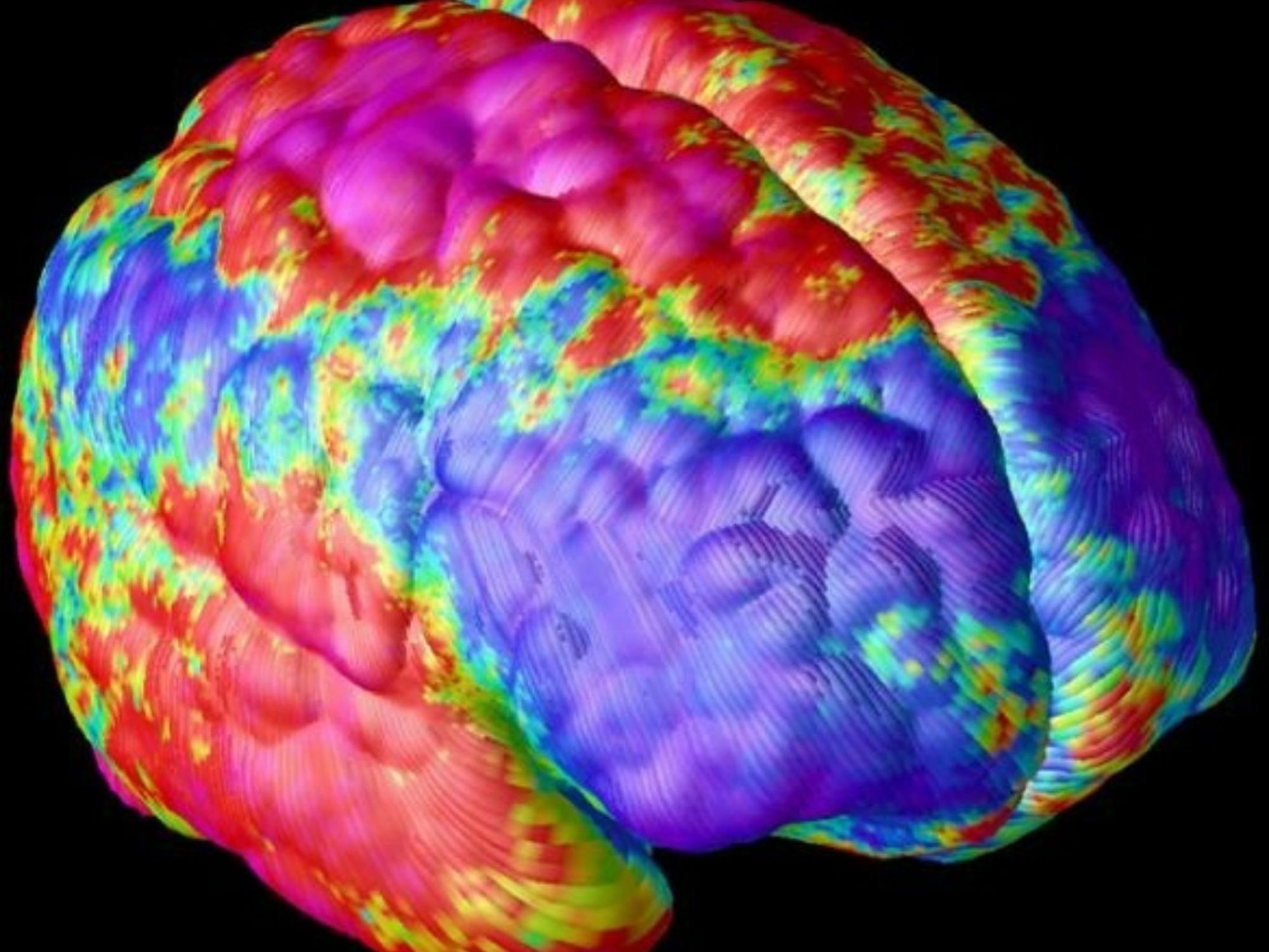 A New Way to Trick the Brain and Beat Jet Lag